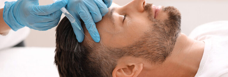 Le plasma riche en plaquette ou PRP et repousse des cheveux.